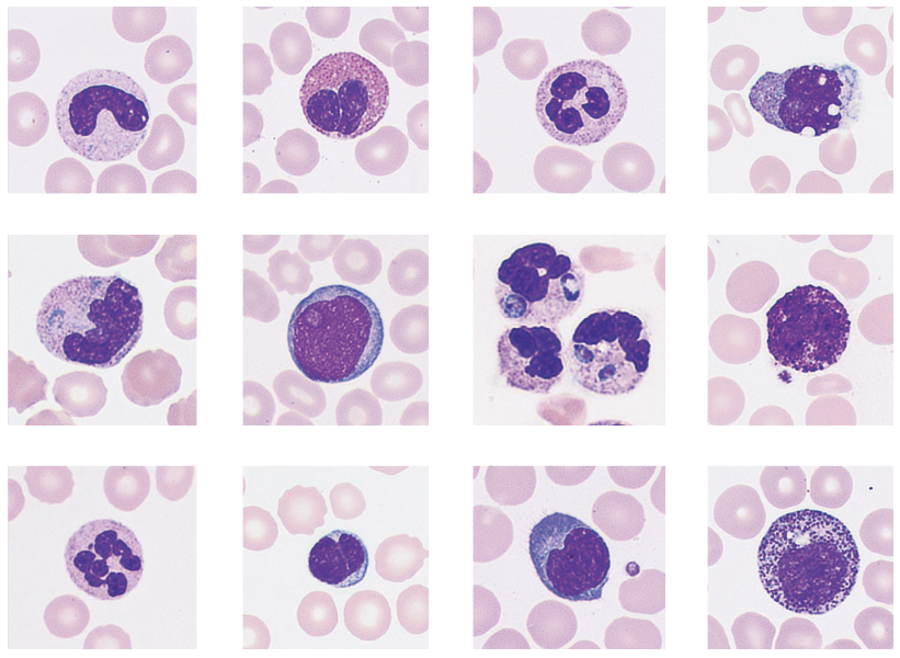 Aktualności / MC-80 Mindray